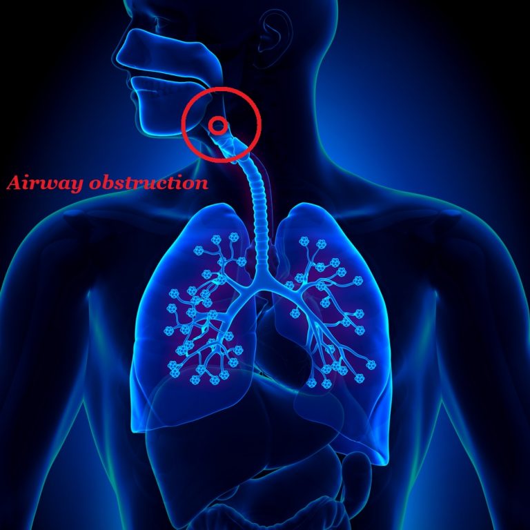 How to Understand Sleep Apnea Using Pulse Oximeters